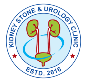 Retrograde Intrarenal Surgery (RIRS): A Modern Solution for Kidney ...